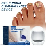 Nail Fungus with Light Therapy Device, Clinically Results - Walmart.com