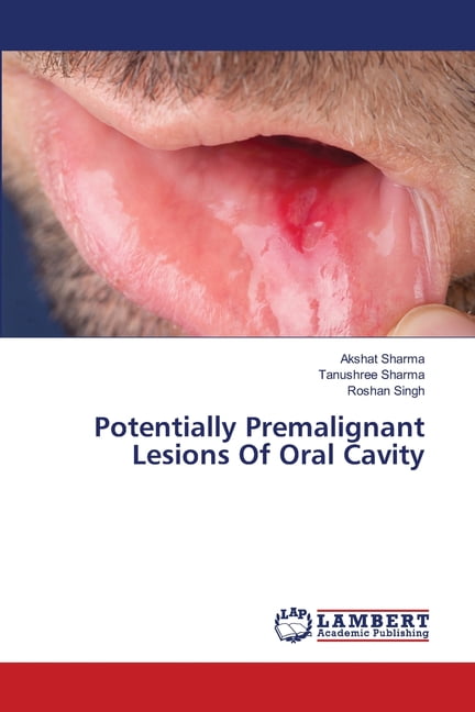 Potentially Premalignant Lesions Of Oral Cavity (Paperback) - Walmart.com
