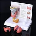 Thyroid Anatomy Model - Thyroid Nodule Model,3:1 Showing The Thyroid ...