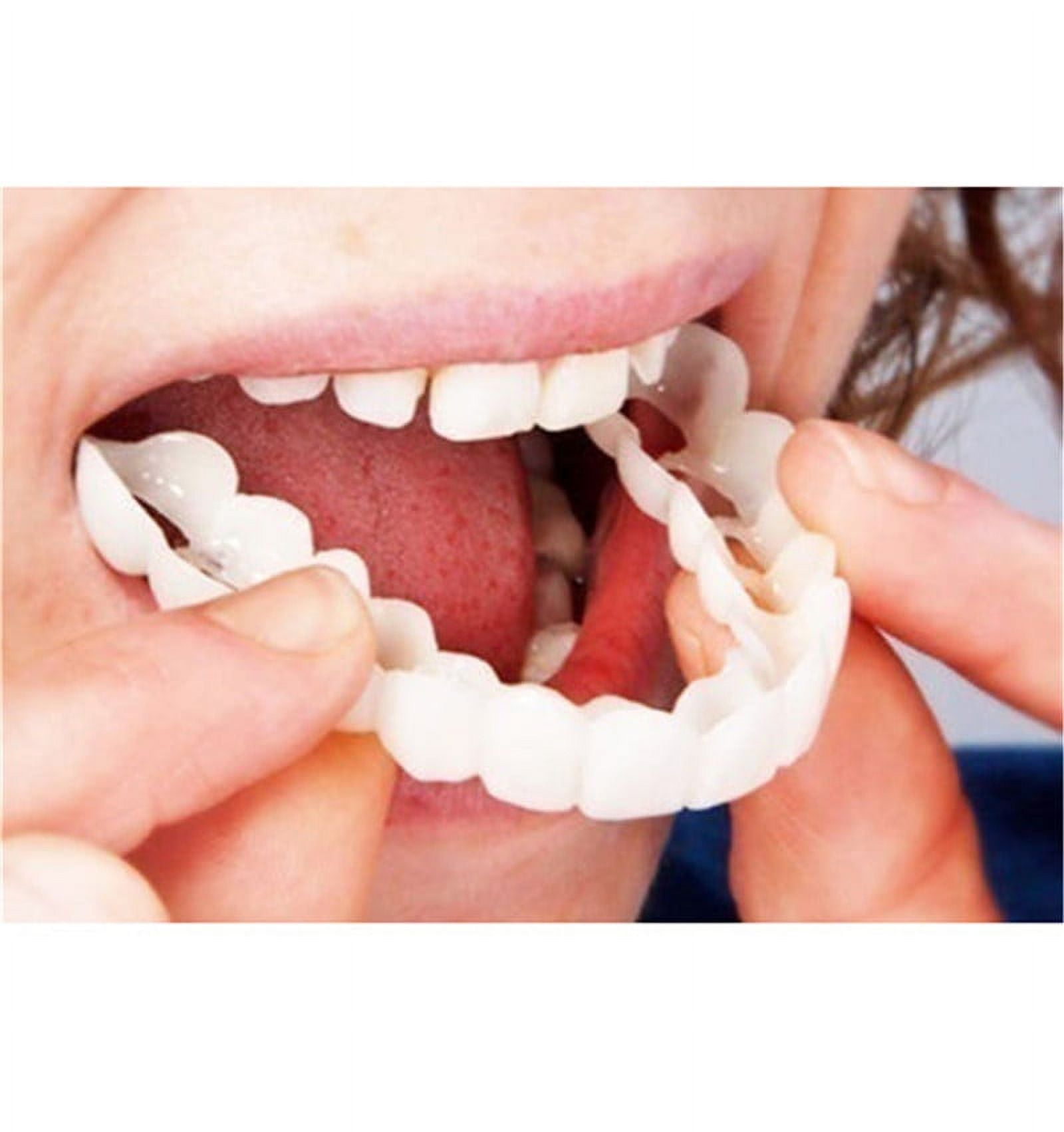 Dientes falsos, dentadura postiza, carillas temporales a presión ...