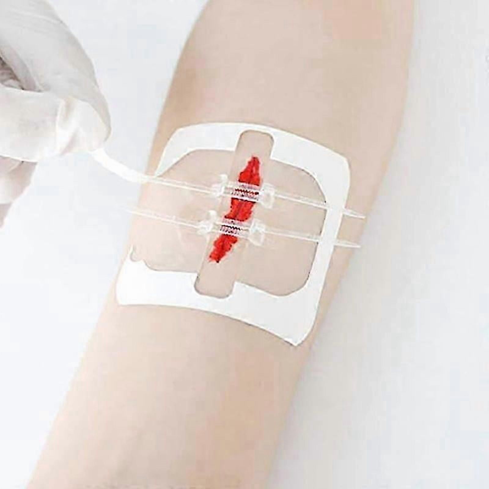 2 Pack Medical Zip Ties - Wound Closure Strips for Hemostatic and ...