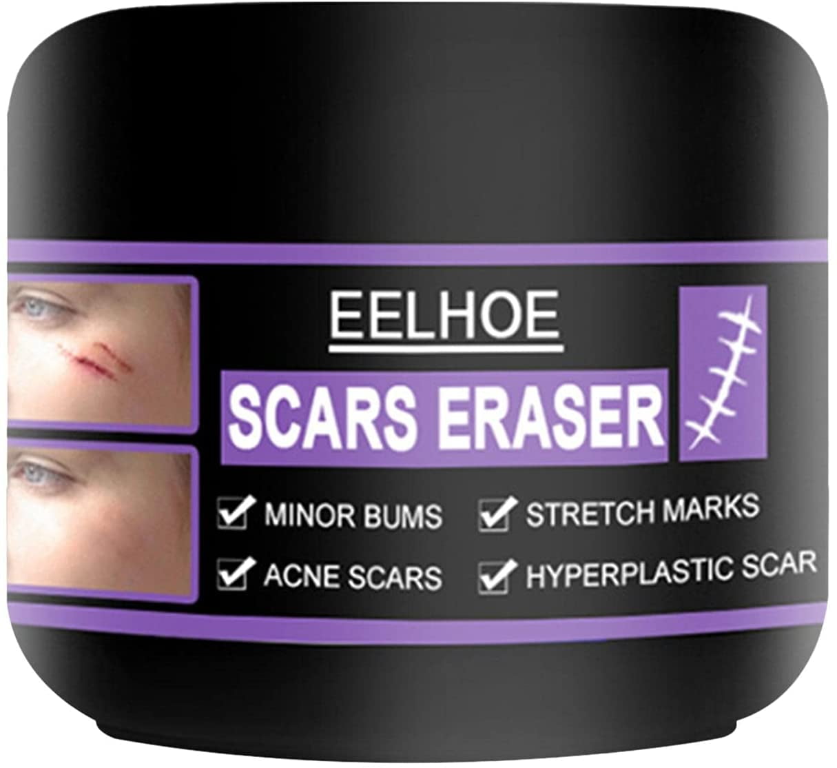 Scar Removal Cream, Scar Cream for Old Scars & New Scars Effective Scar ...