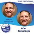 Temptooth #1 Seller DIY Temporary Tooth Replacement Kit, Missing Tooth ...