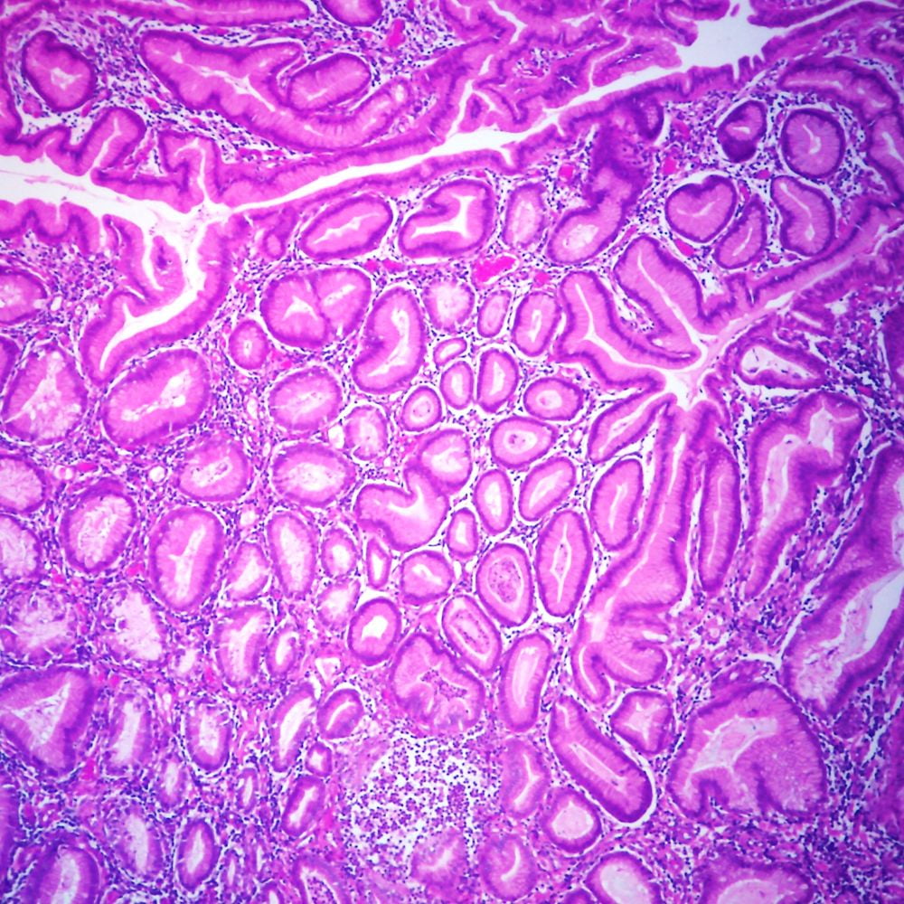Colon Slide