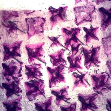 Spider Prepared Microscope Slide, Whole-Mount - Walmart.com