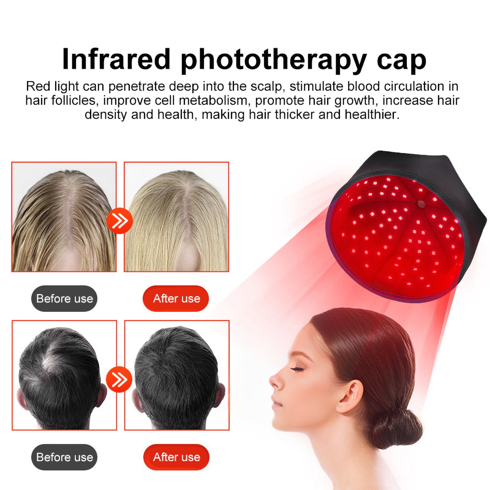 Does Red Light Therapy Help Alopecia | Shelly Lighting