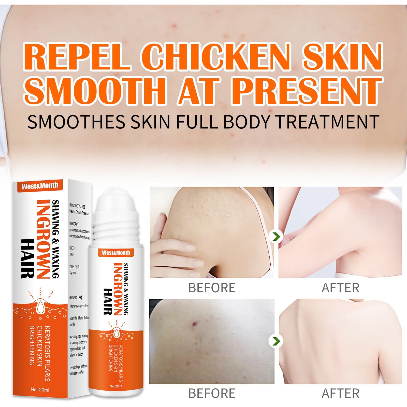 Click here for Openpig Razor Bumps Treatment For Women And Men  I... prices