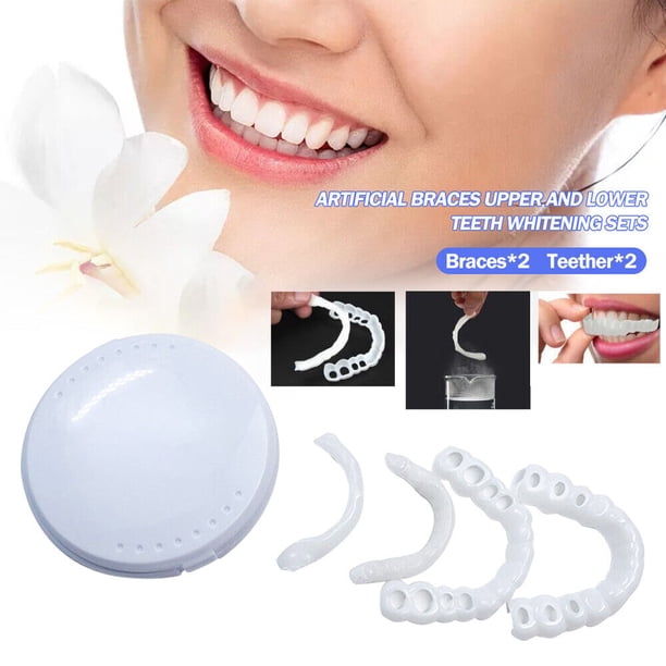 Snap Dental Veneers