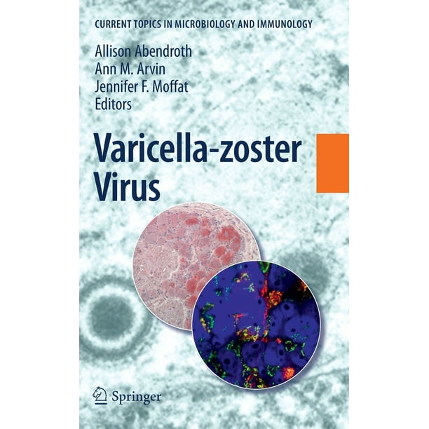Current Topics In Microbiology And Immmunology Varicella Zoster Virus Series 342 Hardcover current-topics-in-microbiology-and-immmunology-varicella-zoster-virus-series-342-hardcover