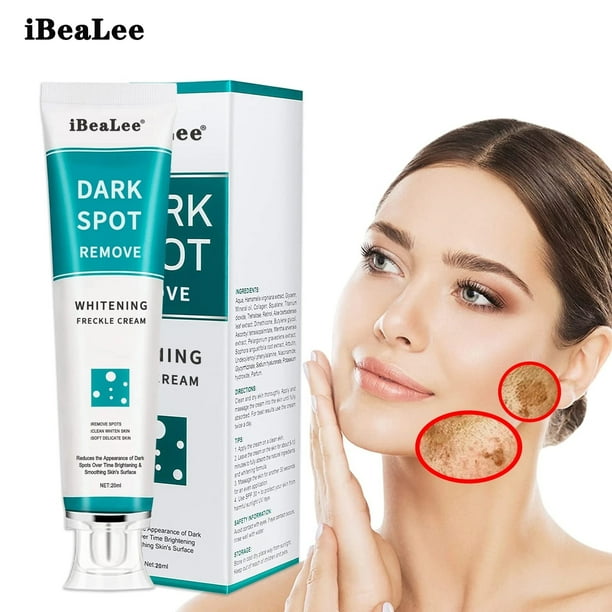 Crema blanqueadora para pecas Tan Jianjun unisex 20 g para Eliminar melasma y manchas oscuras ...