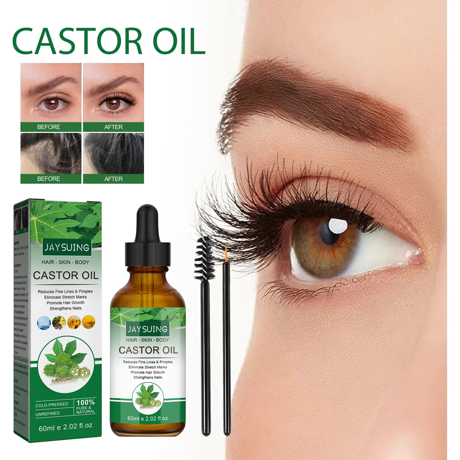 Castor Oil Before And After Stretch Marks