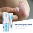 3pcs Anti Itch Herbal Cream For Psoriasis Dermatitis Eczema 20g