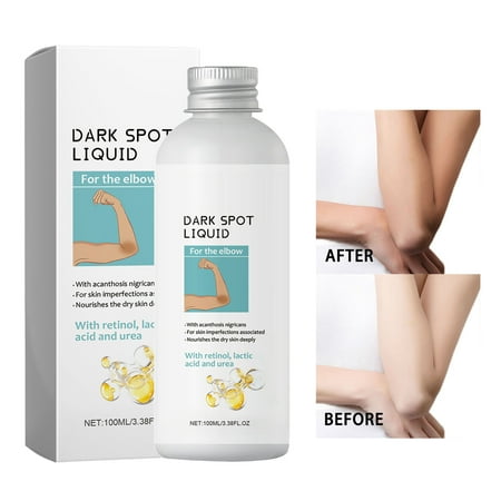 Elbow Lotion Lightens Joint Dullness Nourishes And Skin To An Even And ...