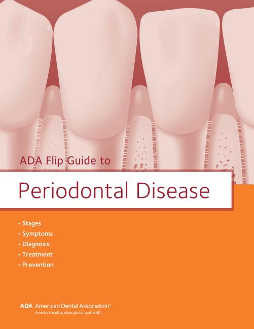 ADA Flip Guides ADA Flip Guide To Periodontal Disease Other Walmart Walmart ADA Flip Guides ADA Flip Guide To Periodontal Disease Other Walmart Walmart