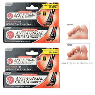 Miconazole Nitrate 2% Antifungal Cream, 1 Oz. - Walmart.com
