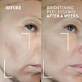 Dr. Brandt Dr. B Lab. Brightening Peel Essence 100 ml - Walmart.com