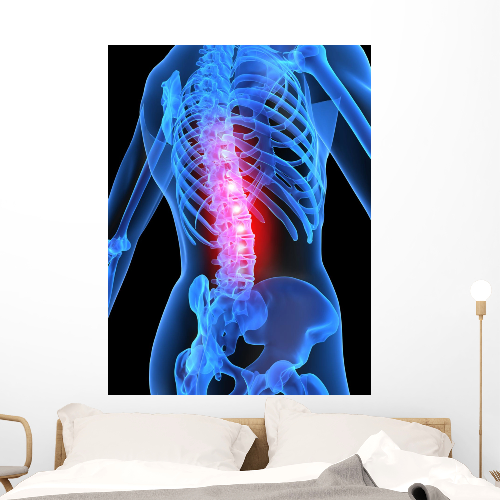 Skeleton with Back Pain Wall Mural by Wallmonkeys Peel and Stick ...