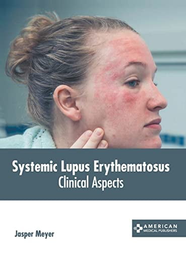 Pre-Owned Systemic Lupus Erythematosus: Clinical Aspects, 9781639272129 ...