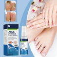 Lizheee Feet Peel “Gentle Foot Care Mist Cleanse Brighten & Nails ... Lizheee Feet Peel “Gentle Foot Care Mist Cleanse Brighten & Nails ...