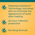 Neosporin Original First Aid Antibiotic Ointment, 1/32 oz, 144 ct ...