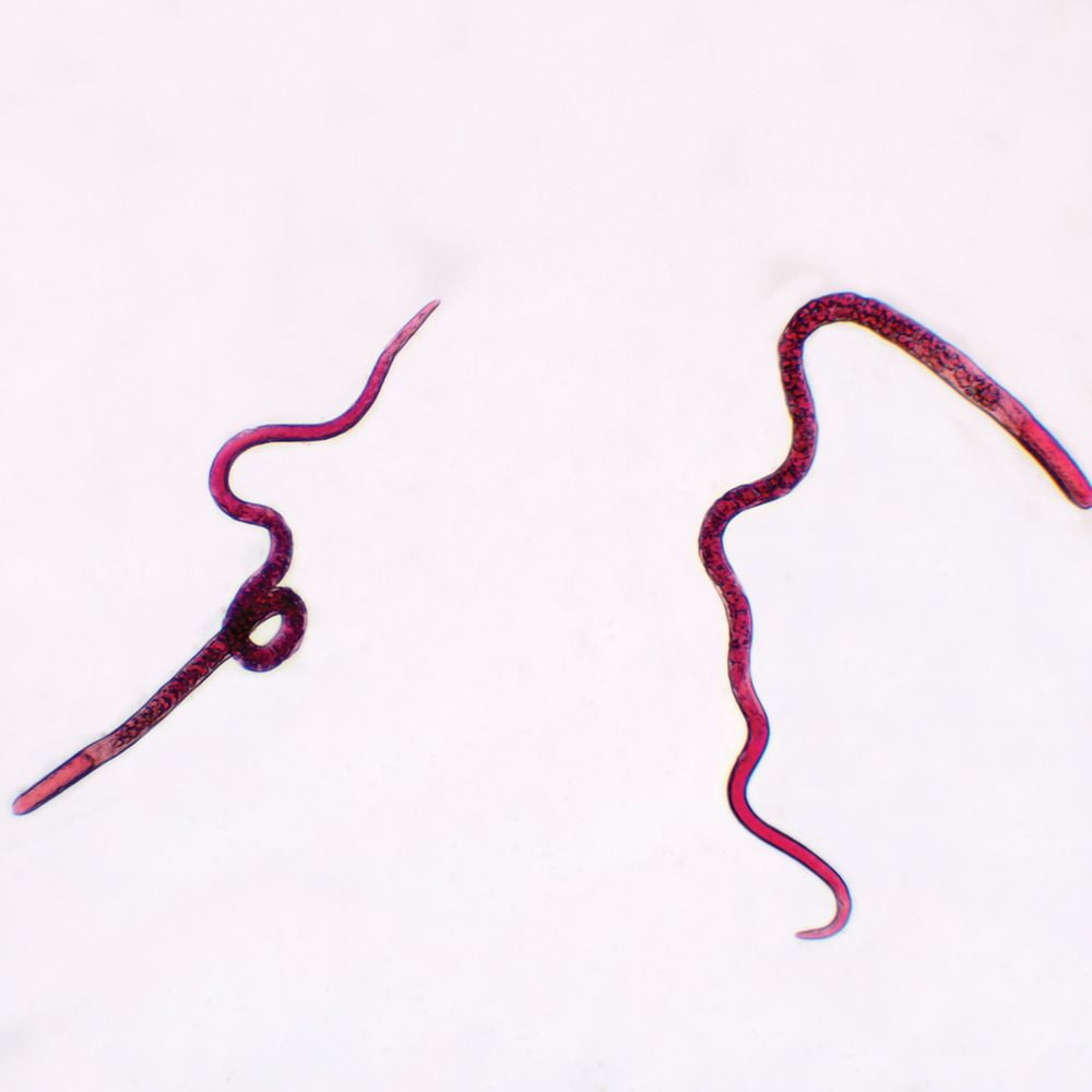 Trichinella Spiralis Female, W.M. Microscope Slide - Walmart.com