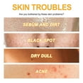 DONGGWTS Exfoliating Gel Deep Cleansing Skin Clearing Blackheads ... DONGGWTS Exfoliating Gel Deep Cleansing Skin Clearing Blackheads ...