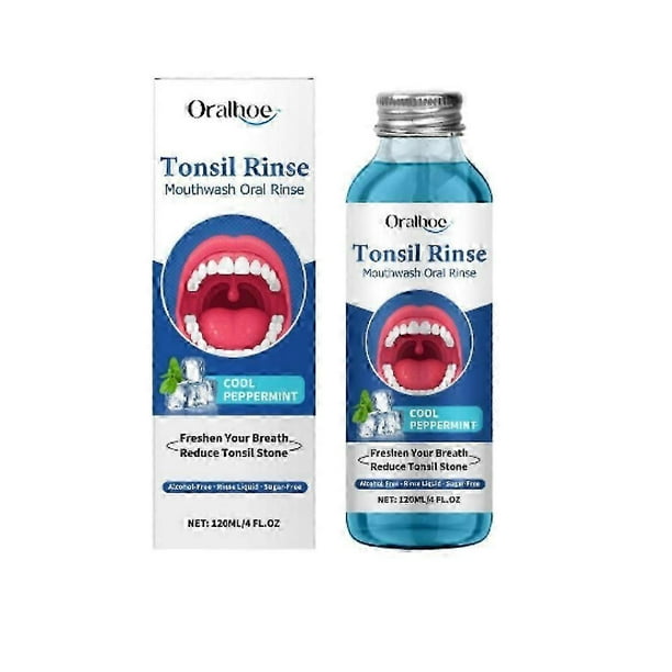 1-3x 120ml Tonsil Stone Remover, Natural Tonsil Stone Removal , Oral ...