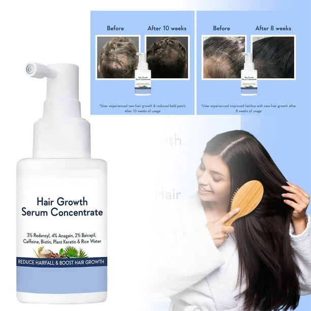 Click here for Wish-Care Hair Growth Serum Concentrate With Plant... prices
