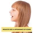 Base Laboratories Piercing Bump Solution, Keloid Scar Removal Drops 0.5 ...