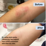 Clearbody Organics 4 oz. Manuka Honey Cream with Colloidal Oatmeal ...