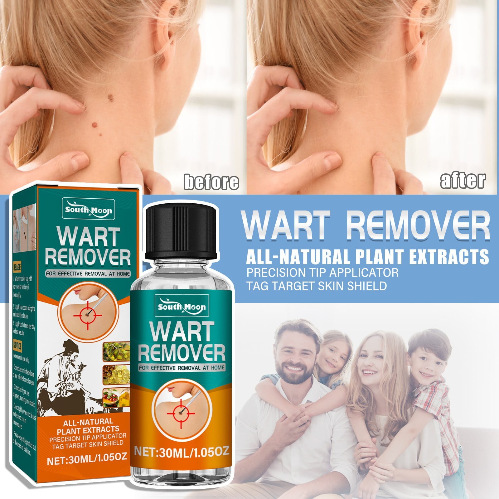 Buy Fast Wart Removal, Gentle Removal of Skin Moles and HPV, Arm and ...