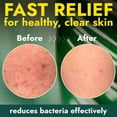 Antibacterial Body Wash with Tea Tree Oil | Antibacterial Soap for Men ...