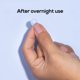 Hanhoo Salicylic Acid Extra Strength Acne Patch, All Skin Types, 36 Ct ...