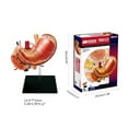 Milue Human Stomach & Pancreas Medical Model Gastric Anatomy Model ...