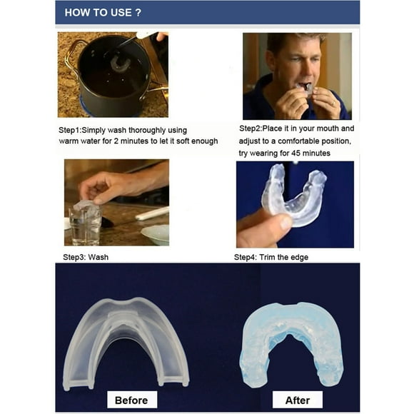 Sleep Apnea Mouth Guards