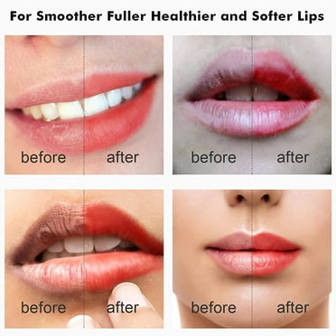 Dermasuri Lip Exfoliator Scrub and Moisturizer, Sugar Lip Scrub ...