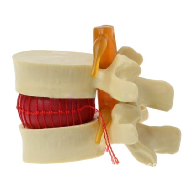 Wweixi PVC Lumbar Vertebrae Model Durable And Reliable Teaching Aid ...