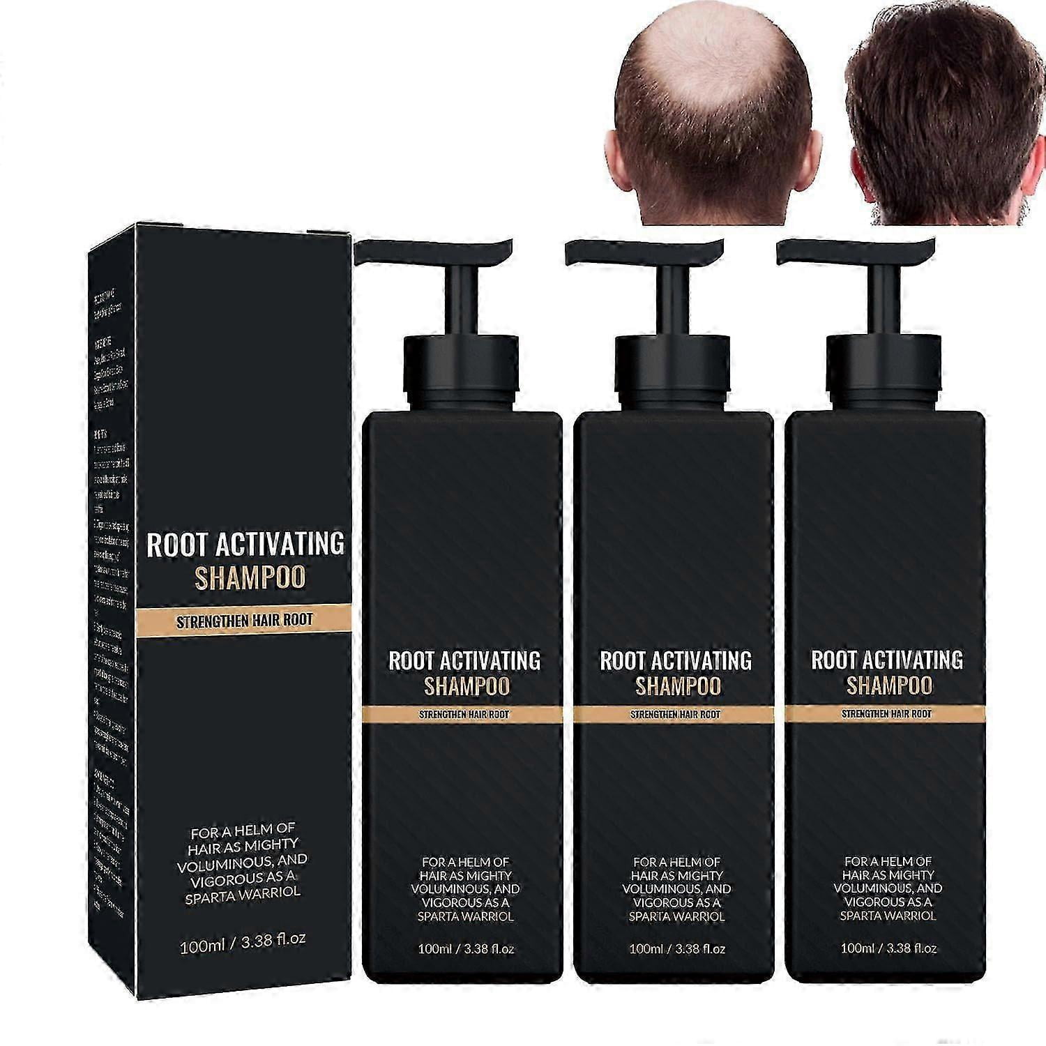 Root Activator Hair Growth Shampoo, Hair Regrowth Shampoos, Hair Loss ...