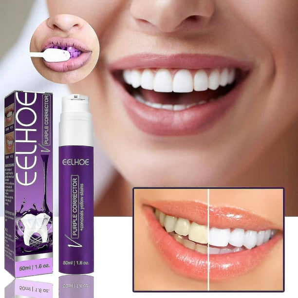 Women Purple Toothpaste Tooth Stain Removal Anti-pigmentation Yellow ...