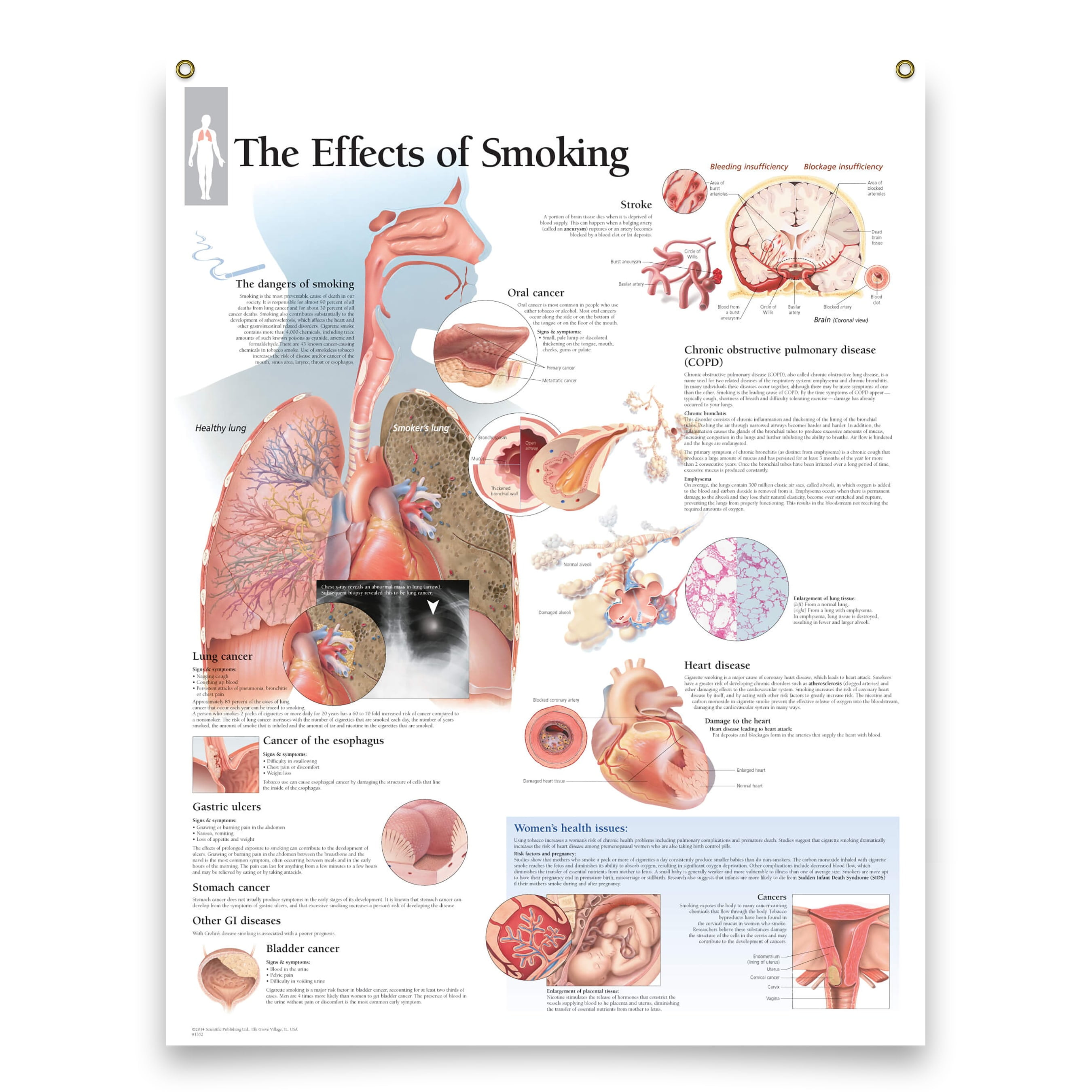 The Effects of Smoking Laminated Medical Educational Informational ...