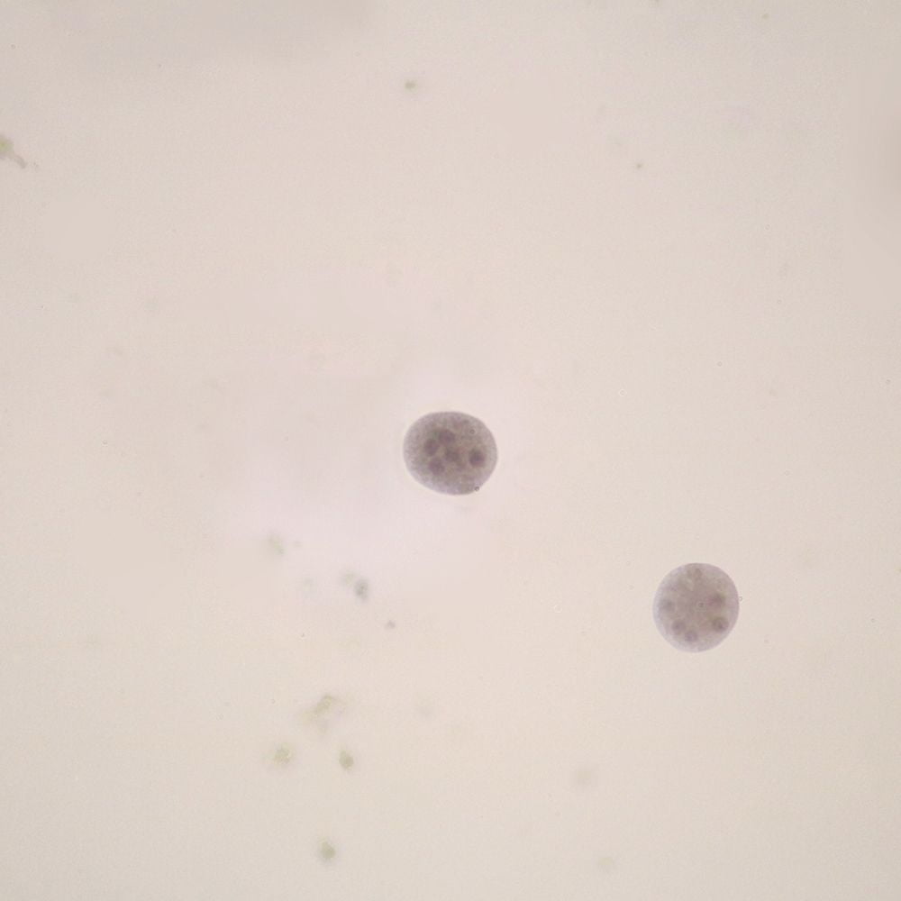 Entamoeba Under Microscope