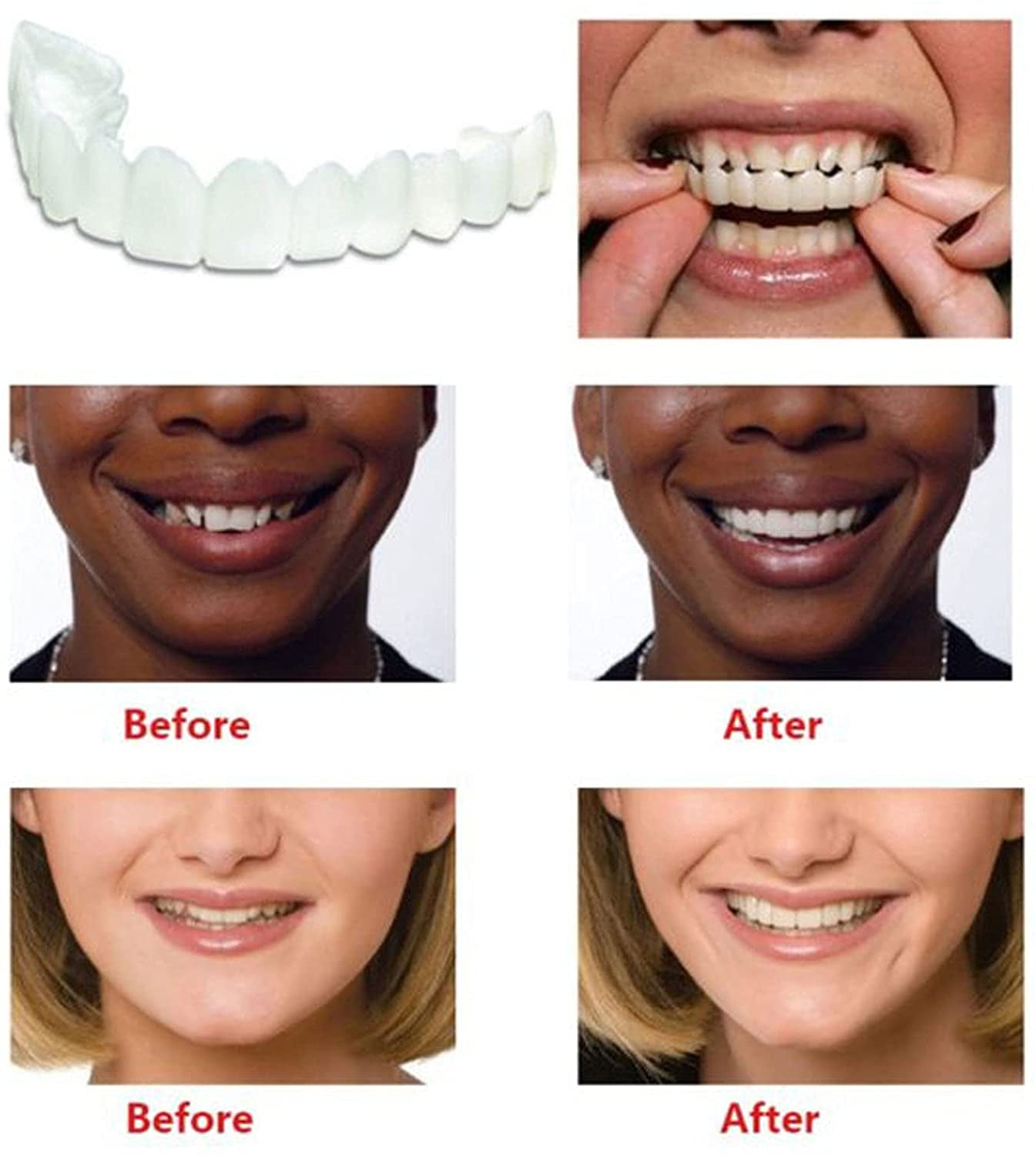 Buy Snap on Teeth Veneers,Perfect Teeth Temporary Replacement Fake ...