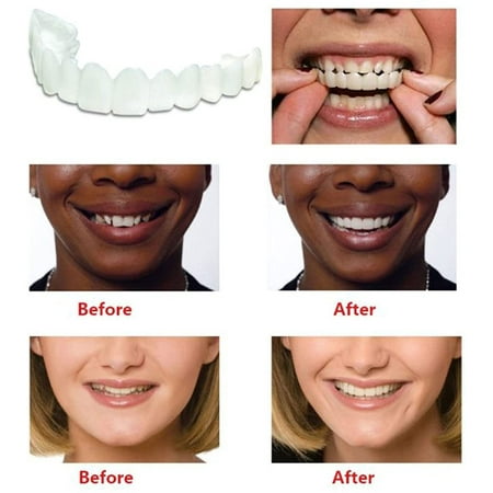 Perfect Teeth Veneers False Tooth Upper & Lower Fake Teeth Smile ...
