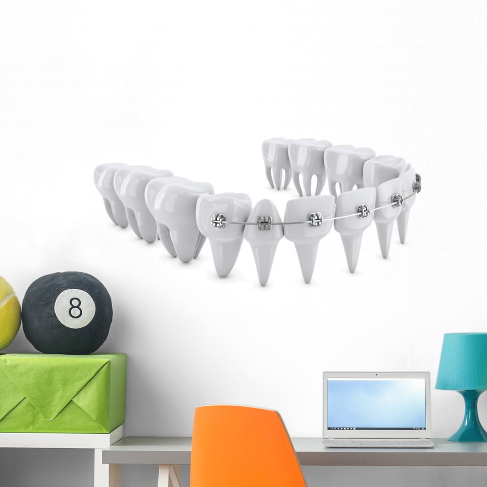 Dental Brackets Wall Mural Decal Sticker, Wallmonkeys Peel & Stick ...