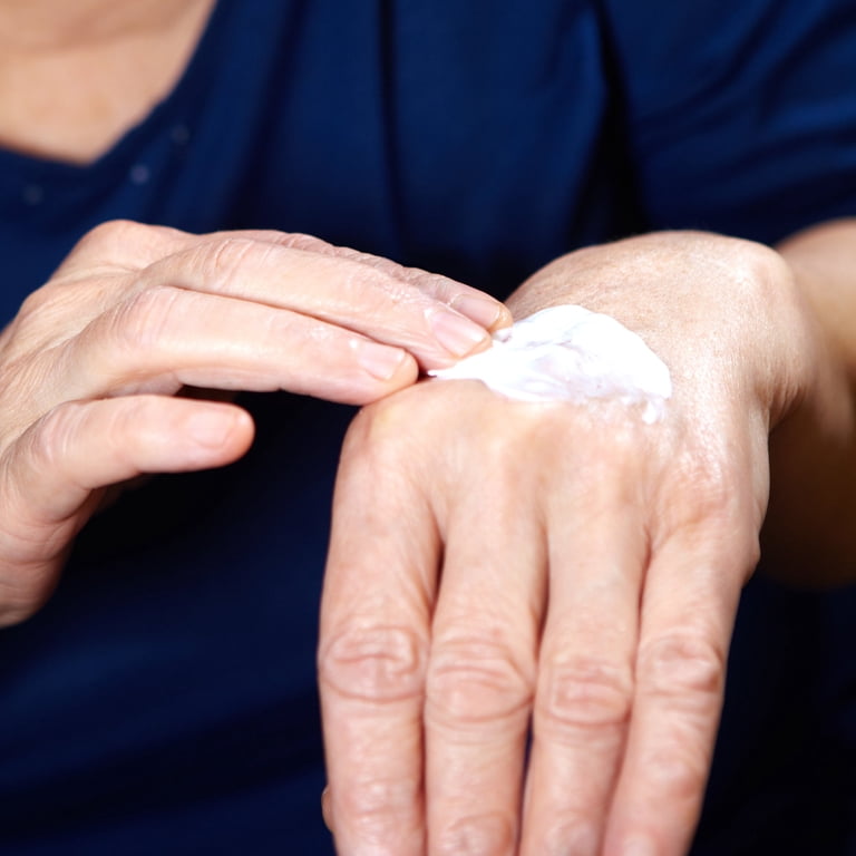 Age Spots On Hands | ppgbbe.intranet.biologia.ufrj.br