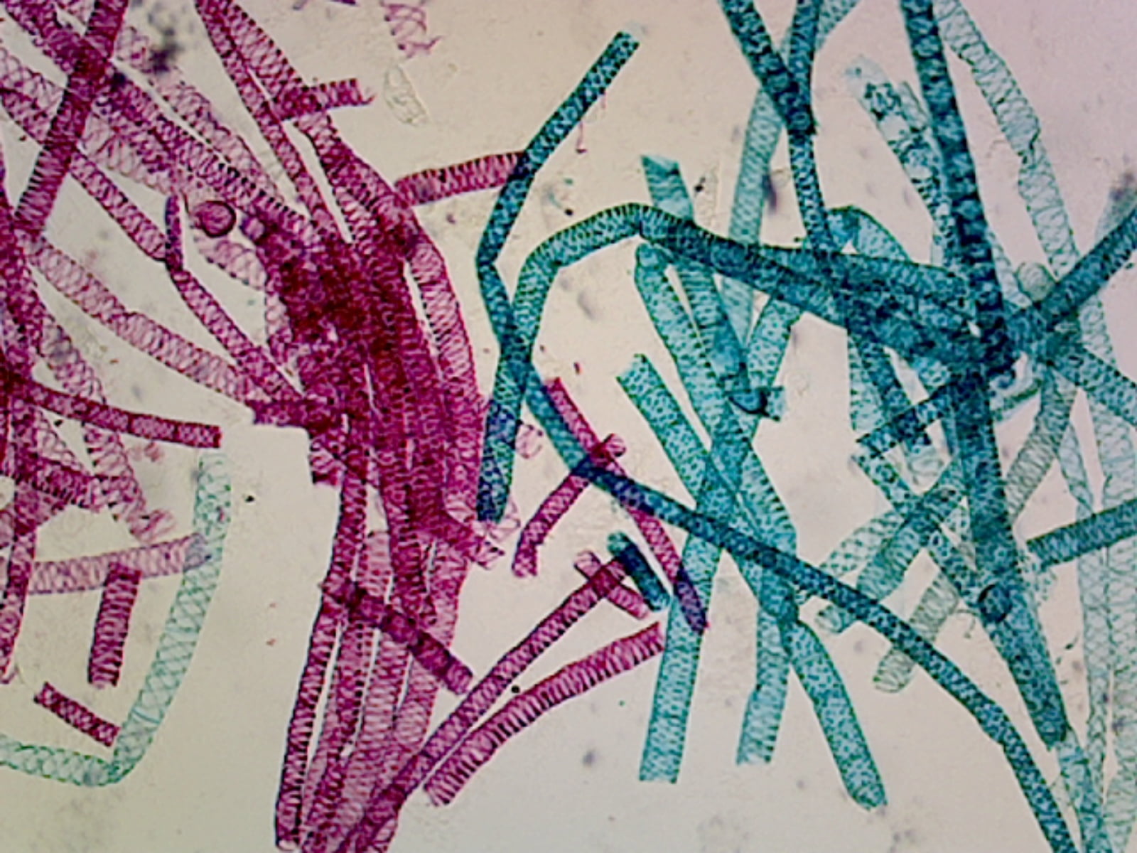 Spirogyra, Vegetative Reproduction; Whole-mount by Go Science Crazy ...