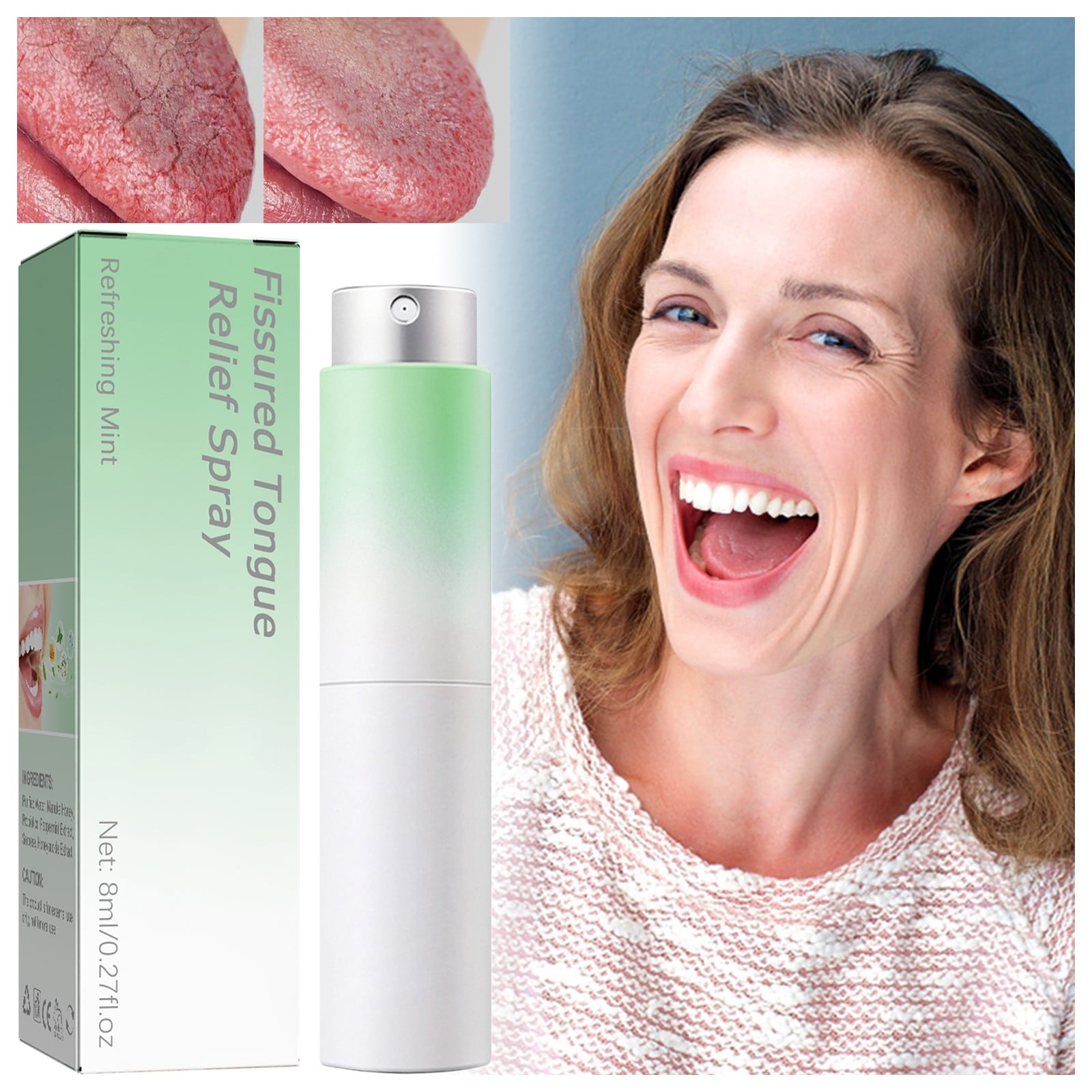 Click here for Cracked Tongue Spray Special Offer  Kitecy Tongue... prices