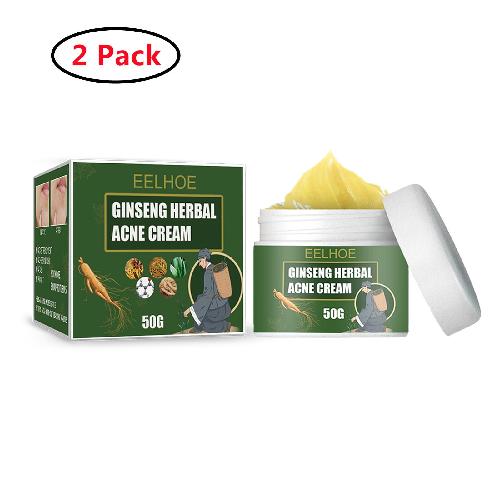 Acne Treatment Face Cream Moisturizer | Tea Tree & Salicylic Acid ...