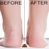 Okay Foot Scrub, Mango Butter, 6 Oz - Walmart.com