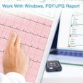 Checkme Pulsebit EX AI ECG Monitor with OLED Touchscreen - Walmart.com